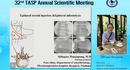 TASP | สมาคมการศึกษาเรื่องความปวดแห่งประเทศไทย